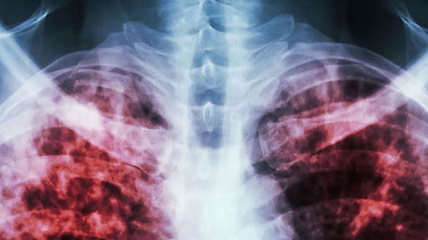 World Community Grid